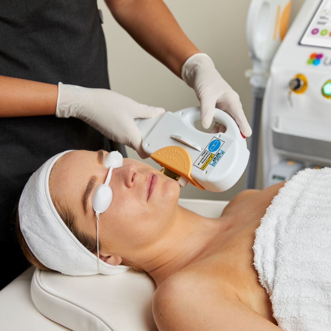 Capillary Removal – Anna Cosmetics